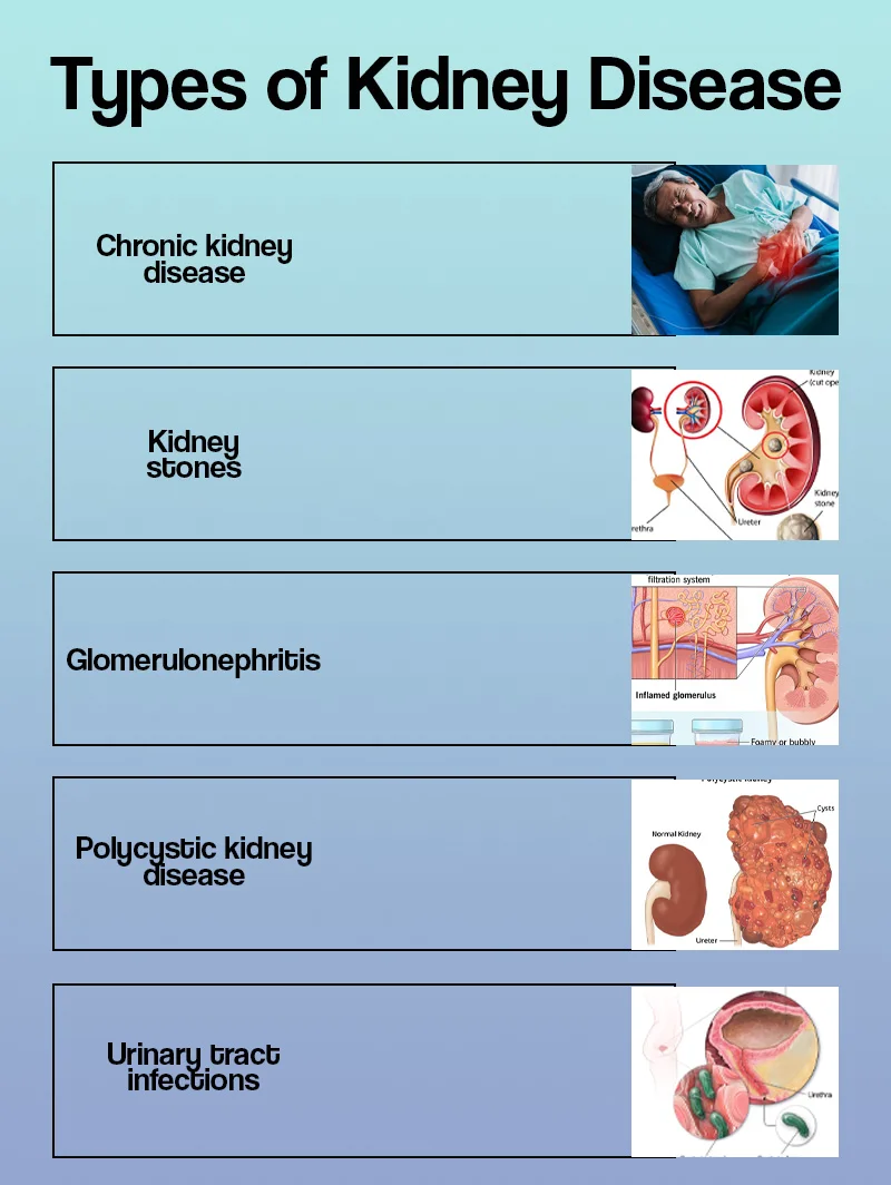 Renal System Diseases