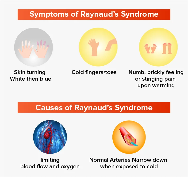 Raynaud39s Disease Causes Symptoms Treatment Raynaud's Syndrome